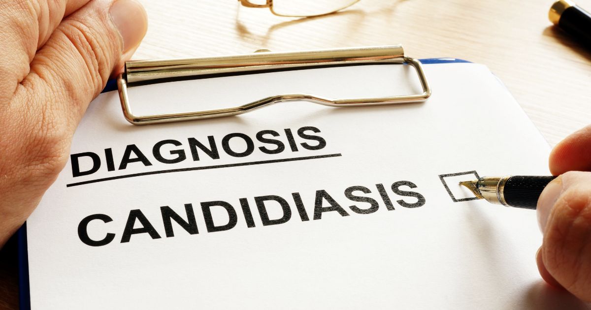 Como Saber se Estou com Candidíase: 5 Sintomas Comuns