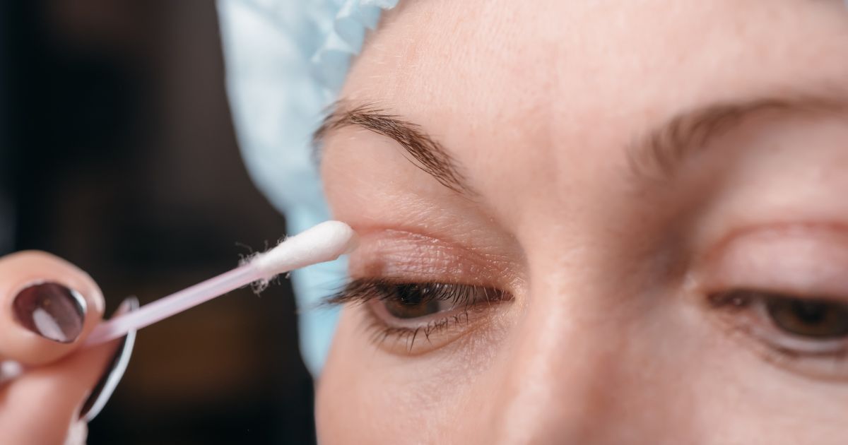 Cirurgia de pálpebras duplas: Procedimento e Recuperação - Novidade ...